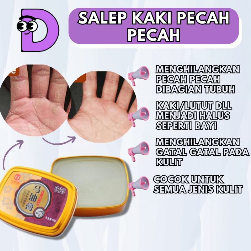 Jual Salep Cream Obat Kulit Tangan Kaki Kapalan Pecah Kasar Mengelupas ...