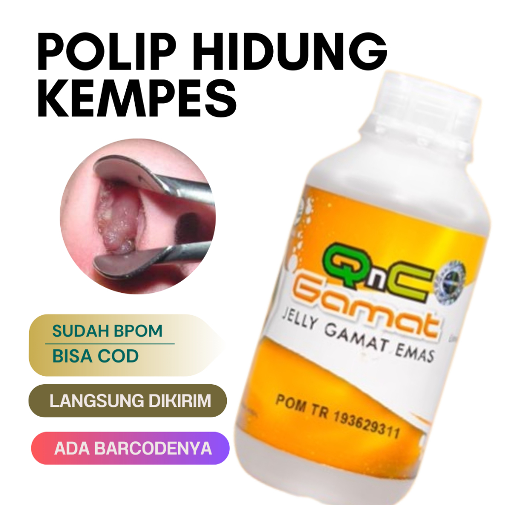 Jual Obat Polip Hidung Anak Dan Dewasa - Benjolan Di Dalam Hidung Herbal Qnc Jelly Gamat Asli ...