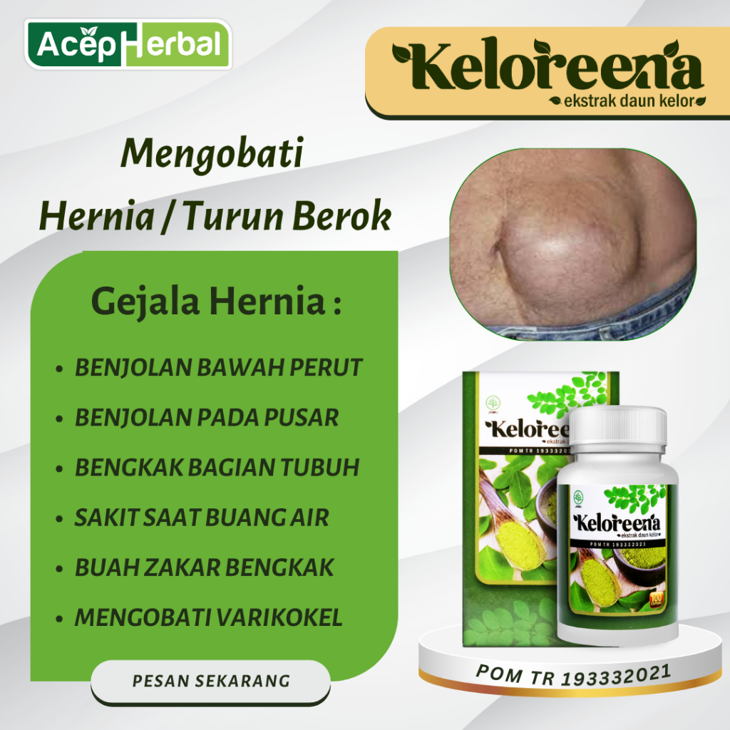 Jual Obat Herbal Untuk Mengatasi Hernia/Turun Berok, Benjolan Pada ...
