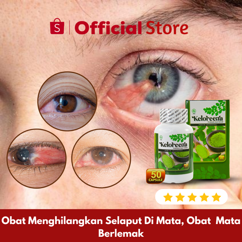 Jual Obat Mata Berlemak, Menghilangkan Selaput Di Mata, Mata Merah ...