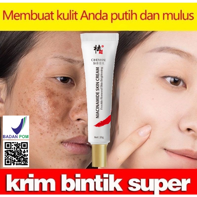 Jual BPOM!! CINDYNAL Niacinamide Skin Cream Remove Dark Spots Penghilang Flek Bintik hitam ...
