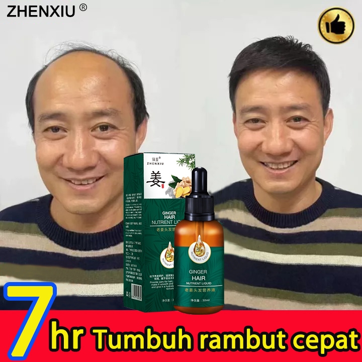 Jual hair tonic-penumbuh rambut botak Menyehatkan Kulit Kepala ...