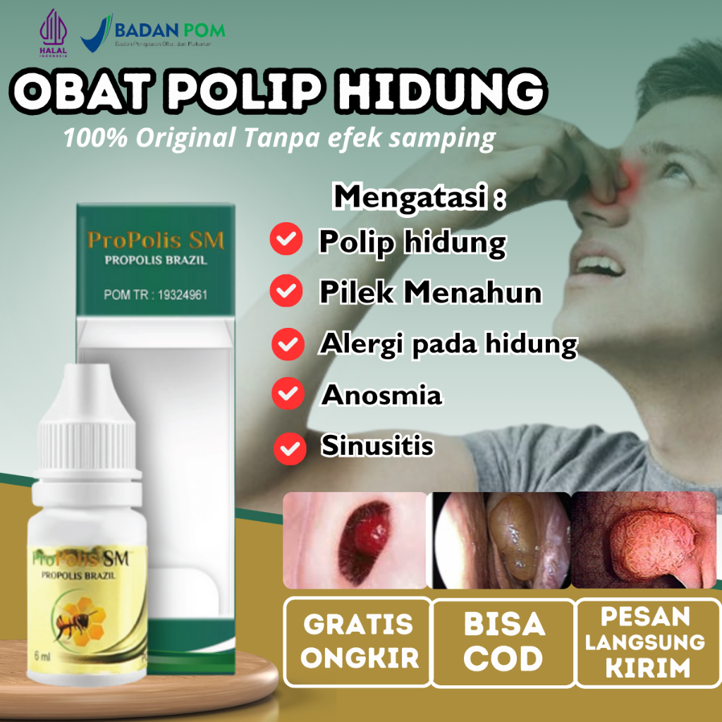 Jual Obat Tetes Polip Hidung, Obat Hidung Tersumbat, Obat herbal Radang ...