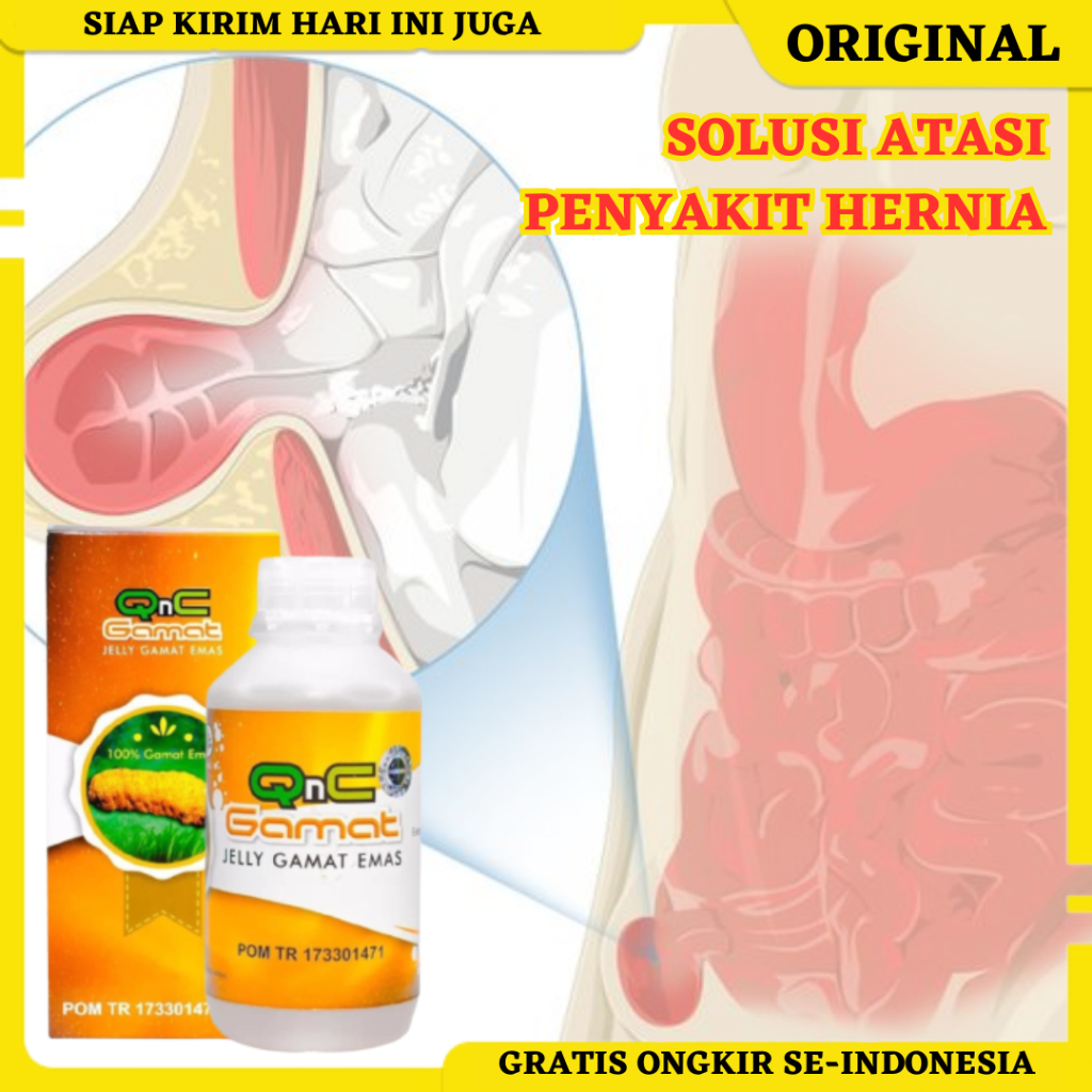 Jual Obat Hernia, Obat Hernia Usus Turun, Obat Usus Menonjol, Obat ...