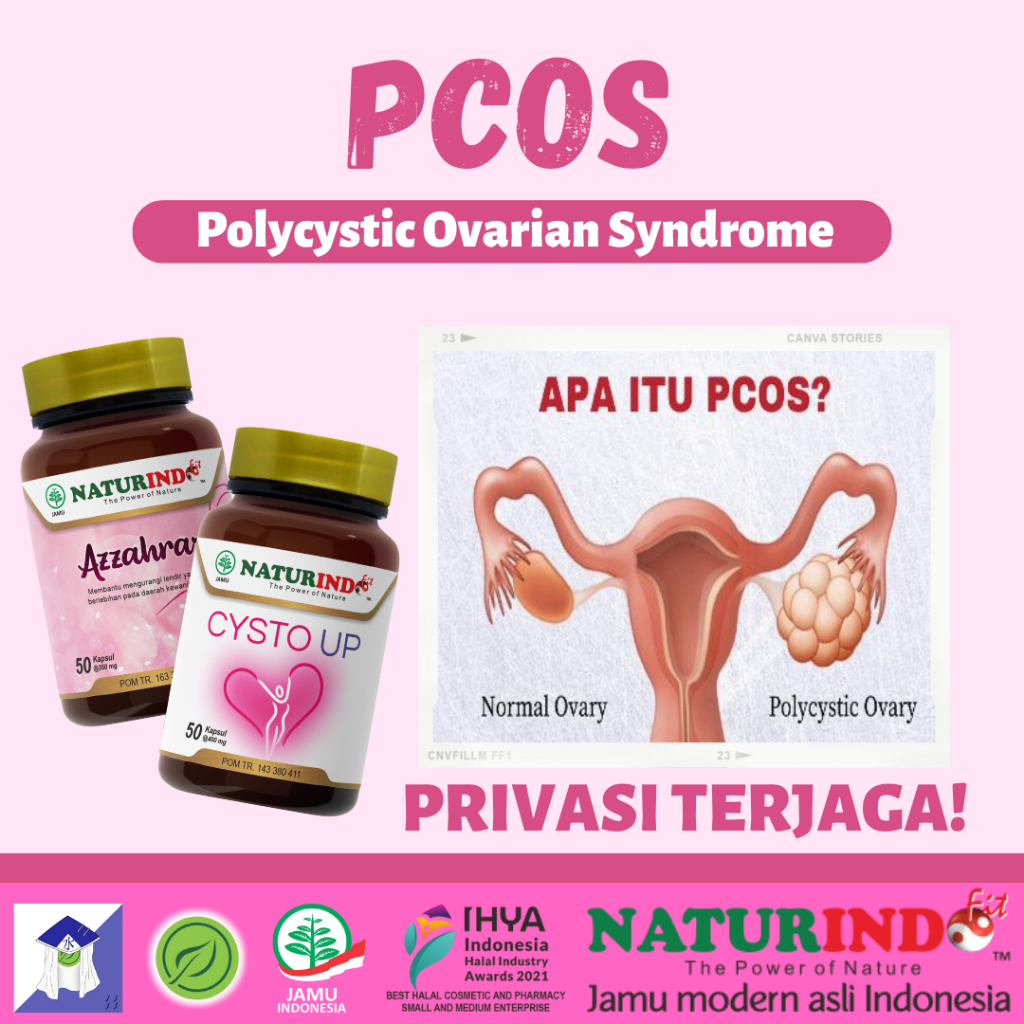 Jual Obat Pcos Polycystic Ovarian Syndrome Sindrom Polikistik Ovarium