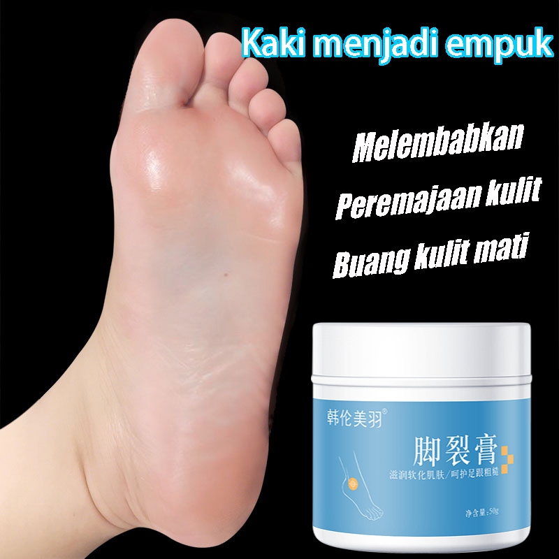 Jual Kering Foot Cream Obat Kaki Pecah Dan Cream Krim Masker Penghilang ...