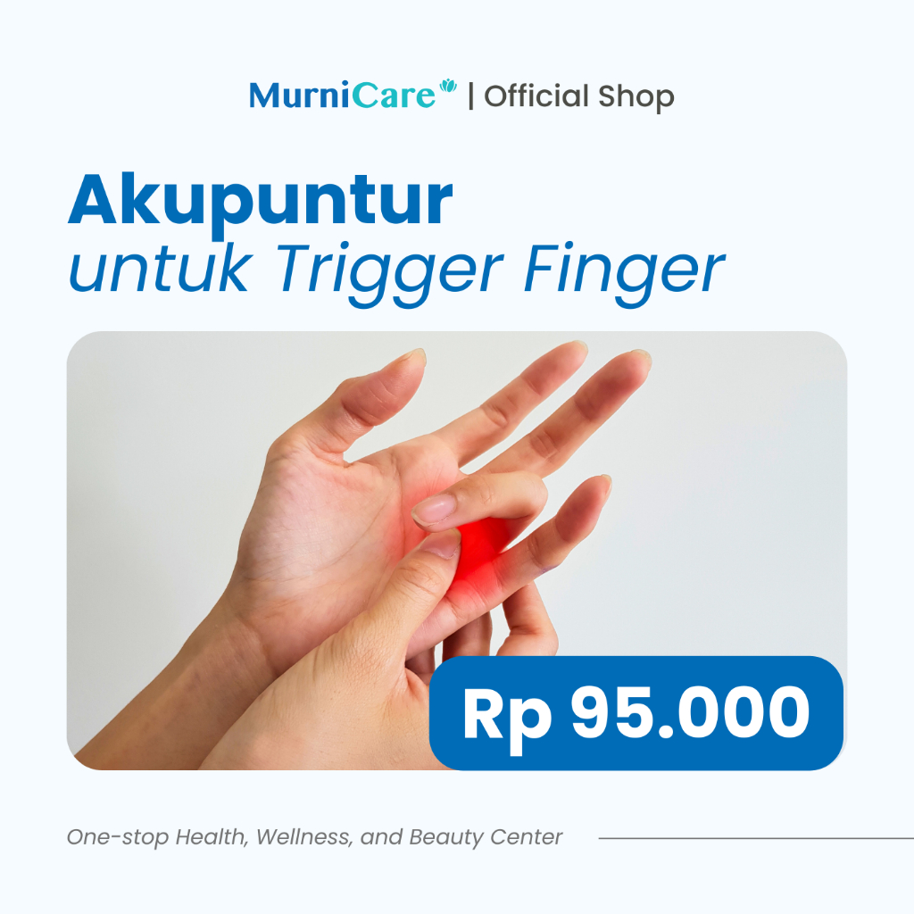 Jual Voucher Akupuntur Trigger Finger - Redakan Nyeri Pada Saraf ...