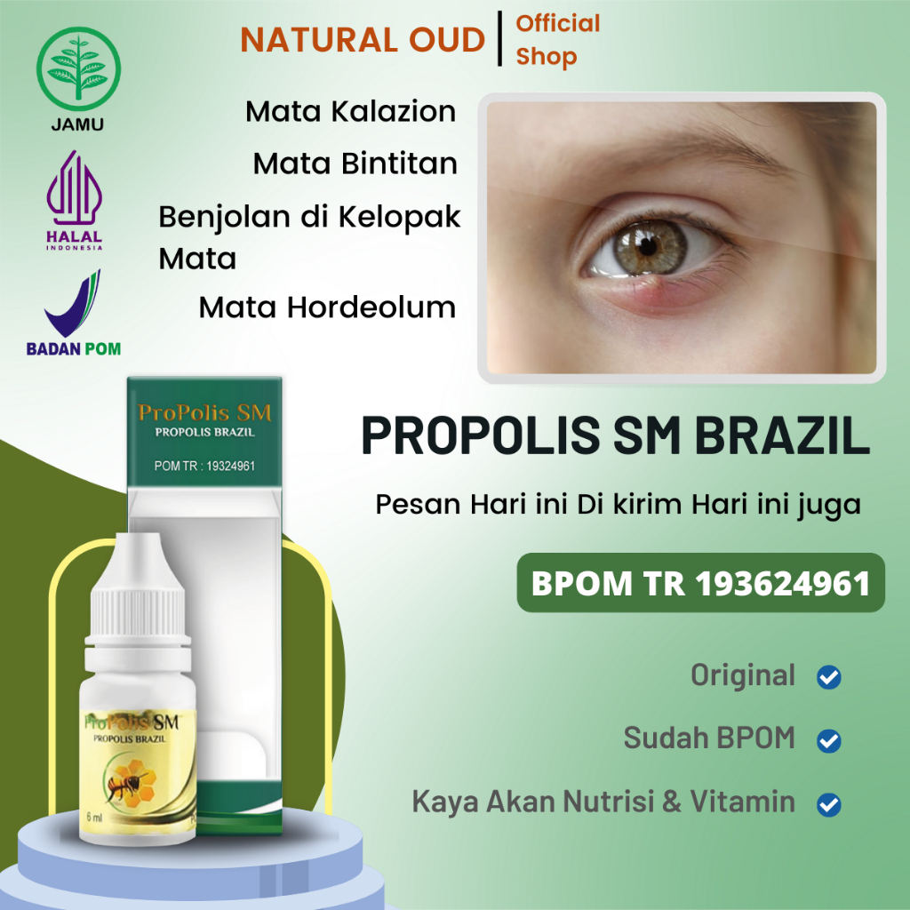 Jual Obat Mata Kalazion, Obat Mata Bintitan Pada Anak Dan Dewasa ...