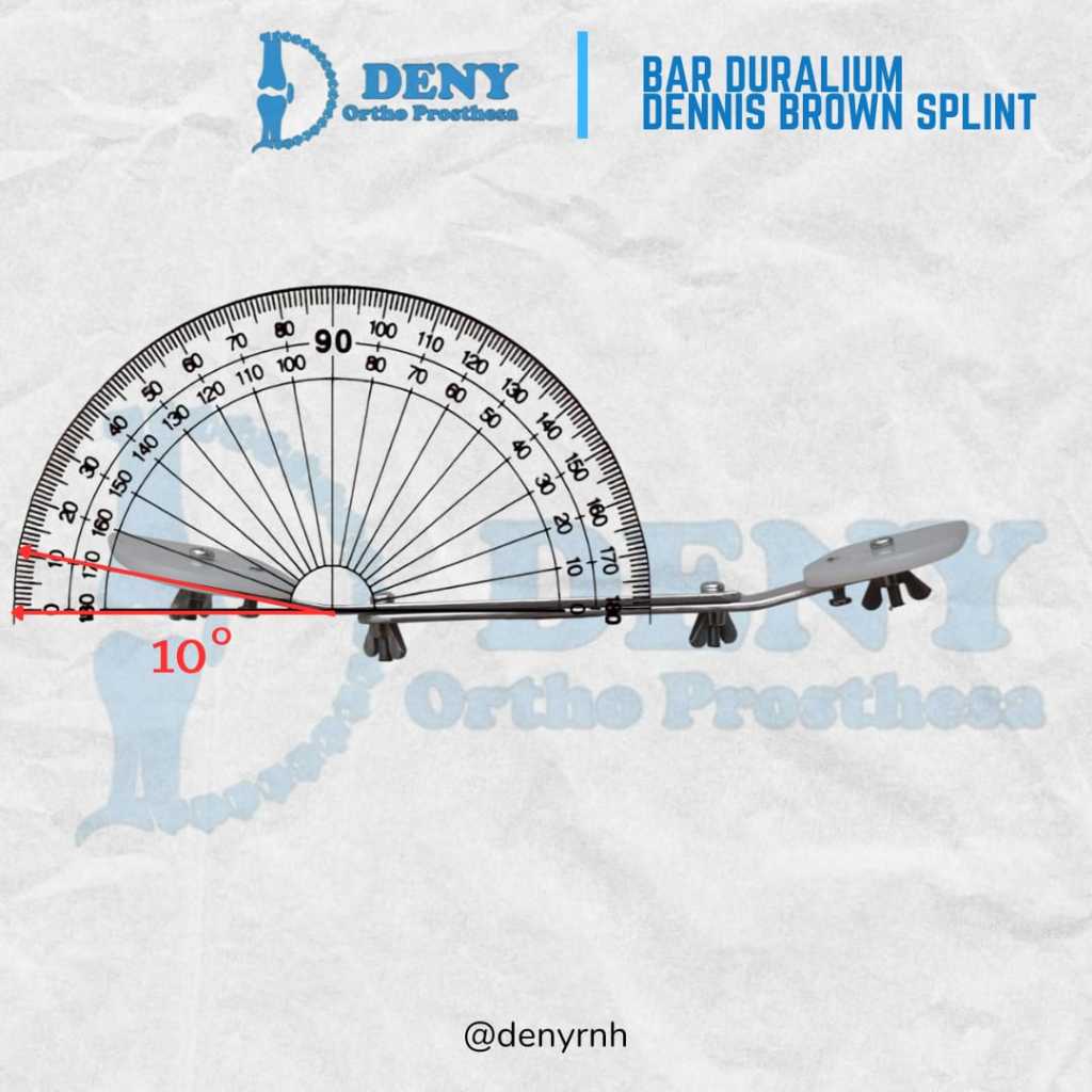 Jual BAR Duralium Dennis Brown Splint (Foot Abdution Brace) | Shopee ...