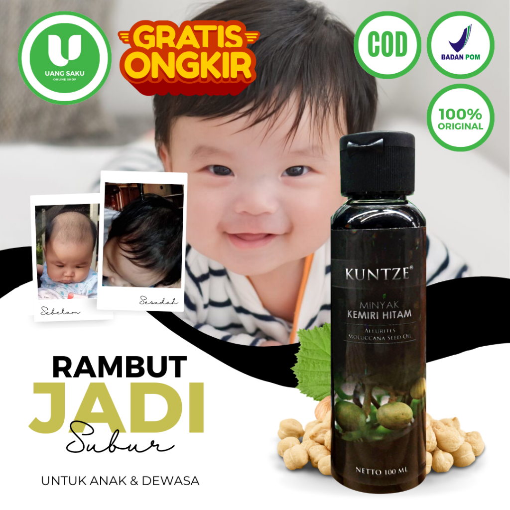 Jual Minyak Kemiri Bakar - Minyak Penghitam Pelebat Rambut Bayi Anak ...