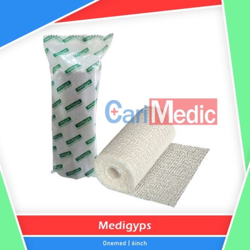 Jual Medigyps 6inch | Gyps Ortopedi OneMed | Gips Patah Tulang | Shopee ...