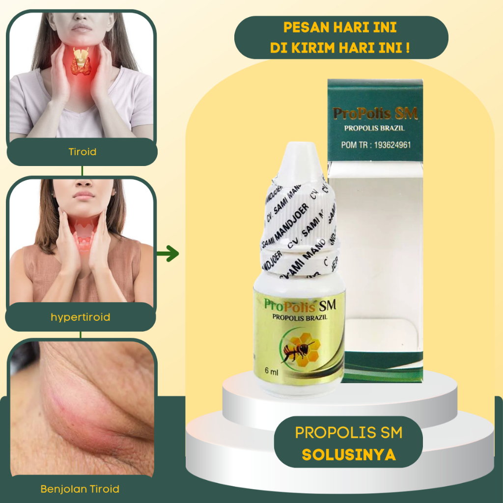 Jual Obat Hipertiroid, Obat Penghilang Hipertyroid, Tiroid Bengkak ...