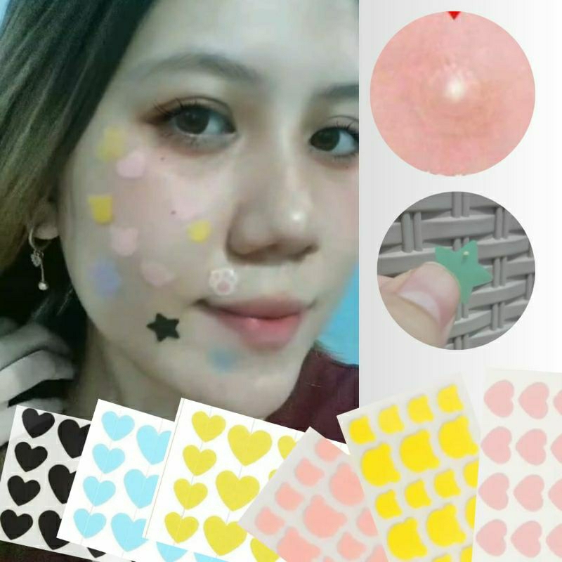 Jual (14pcs)Acne patch Solution /Acne patch lucu karakter viral /Stiker ...