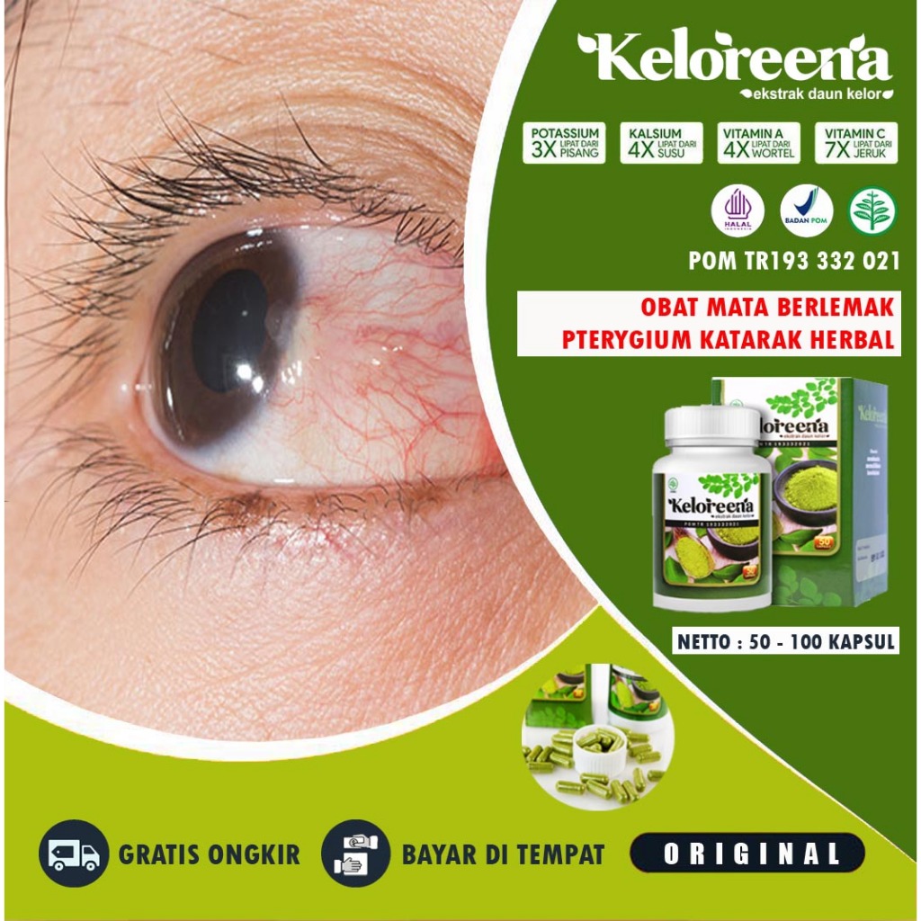 Jual Obat Mata Berlemak Pterigium - Obat Mata Pterygium Mata Minus ...