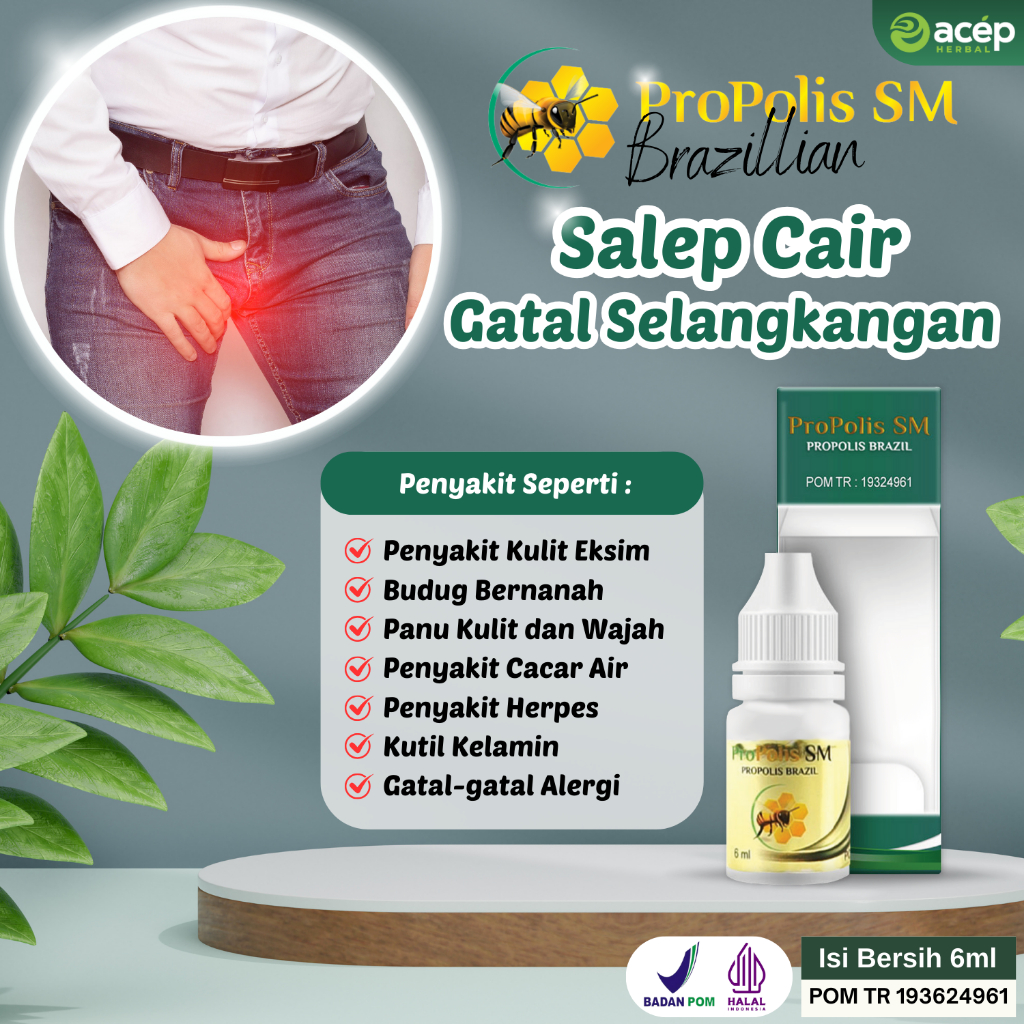 Jual Propolis SM Brazilian Original Obat Gatal Selangkangan Gatal Kulit ...