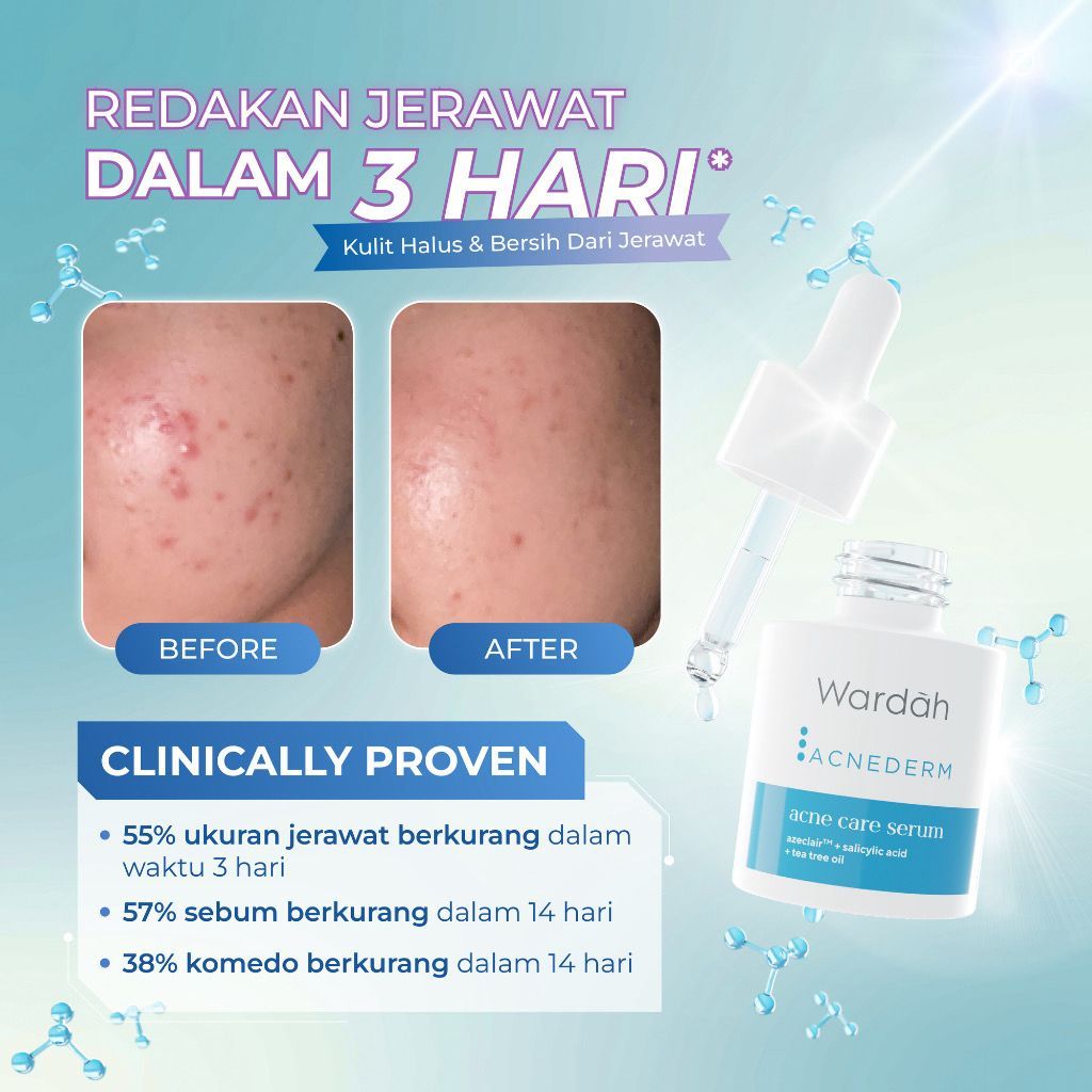 Jual WARDAH Acnederm Series (Spot Gel/Toner/Serum/Moisturizer/Cleanser ...