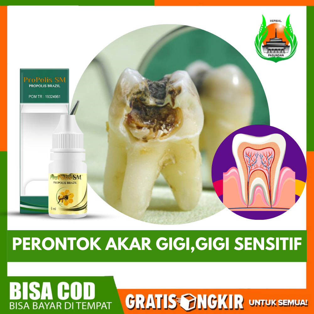 Jual Obat Perontok Akar Gigi, Gigi Sensitif , Gigi Ngilu , Ulat Gigi ...