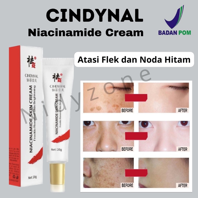 Jual CINDYNAL CREAM PENGHILANG FLEK HITAM NIACINAMIDE SKIN CREAM BPOM 20 ml | Shopee Indonesia