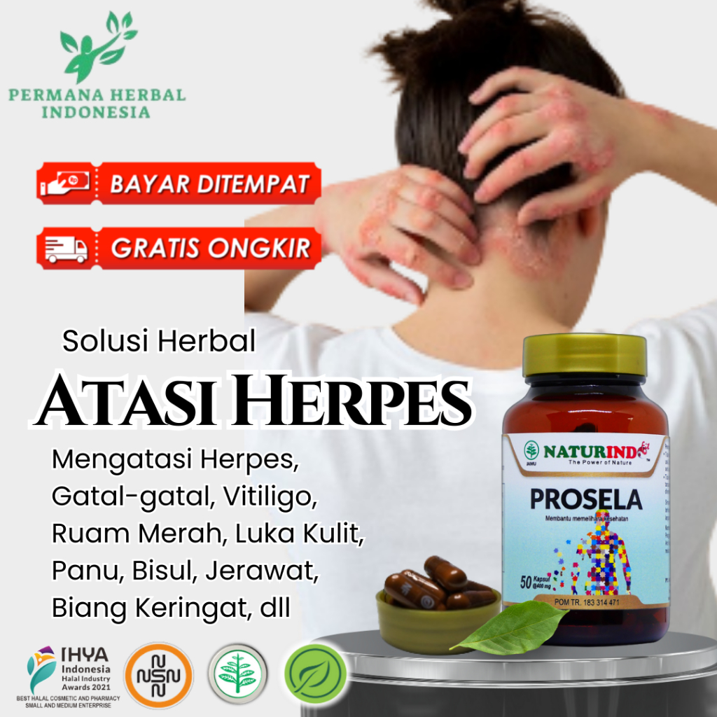 Jual Obat Gatal gatal Kulit Herpes Herbal Vitiligo Gatel Alergi Eksim ...