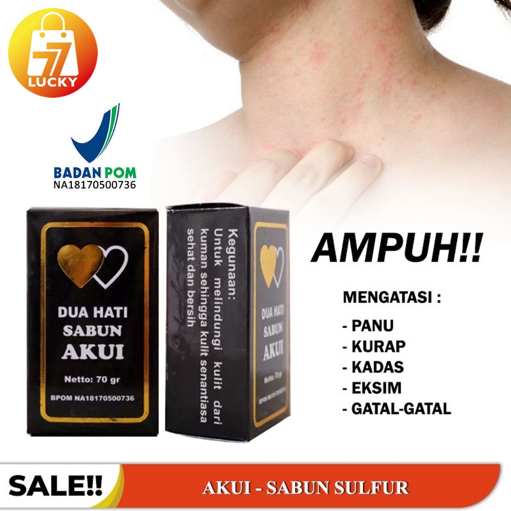 Jual LUCKY77 - [ COD ] BPOM Sabun Sulfur Belerang Akui Dua Hati ...