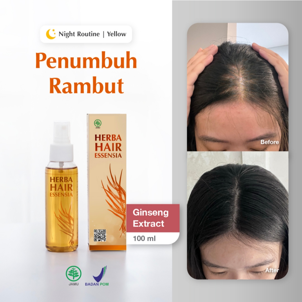 Jual Hair Tonic Essential / herba hair essentia yellow - Kuning 100ml ...