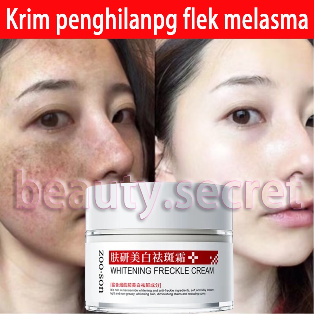 Jual Krim penghilang flek hitam Whitening Freckle Cream 50g Penghilang Bintik Wajah Asli Efektif ...