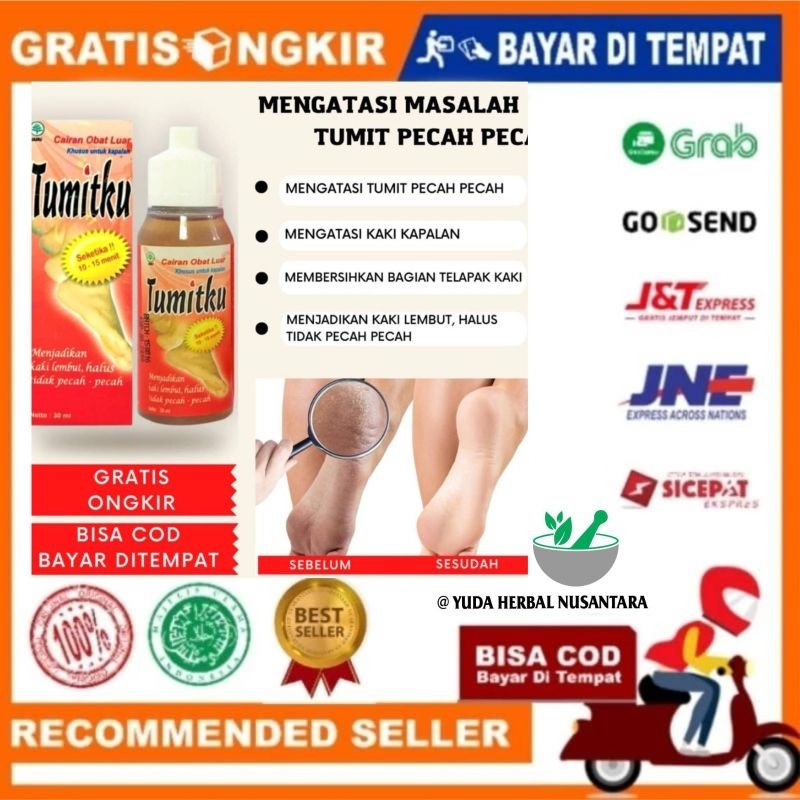 Jual Tumitku Obat Kaki Pecah Original Bpom/Solusi Kaki Pecah Pecah ...