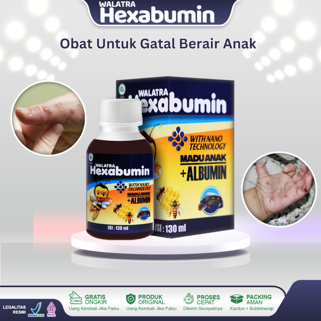 Jual Obat Gatal Berair Pada Anak nfeksi Kuman Gatal Berair Melepuh ...