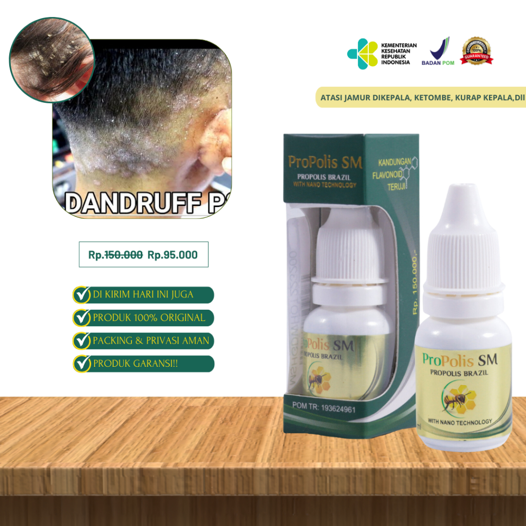 Jual Obat Ketombe Berkerak Parah Berkerak Salep Borok Kulit Kepala Anti Ketombe Psoriasis Kulit ...