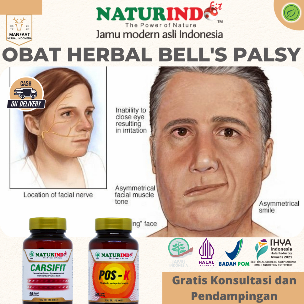 Jual Obat Bell's Palsy Herbal Stroke Wajah Perot Bibir Miring Saraf ...