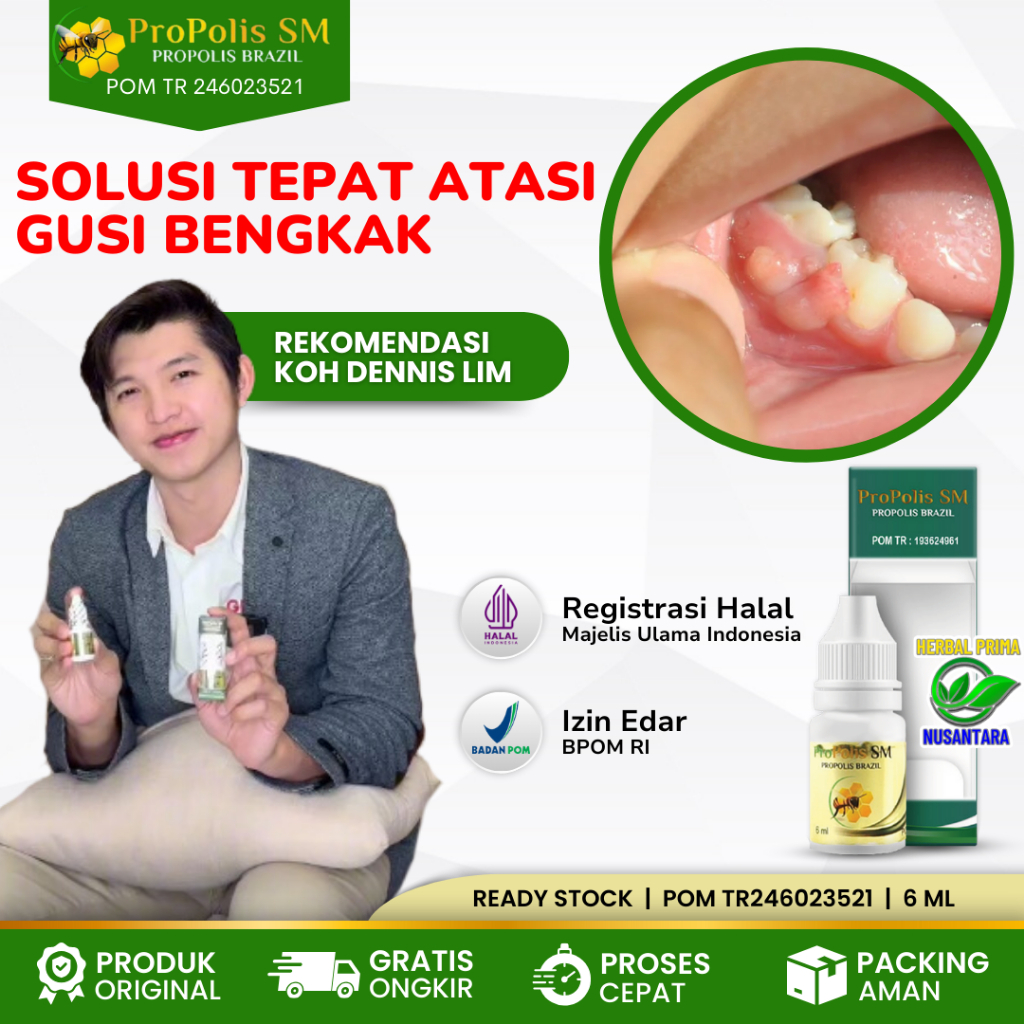 Jual Obat Tetes Abses Gusi - Obat Gusi Bernanah Radang Dan Nyeri Gusi ...
