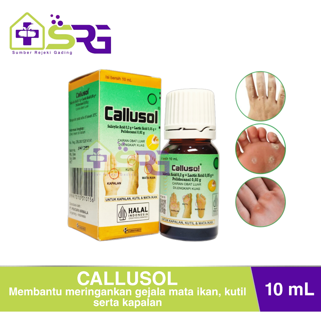 Jual Callusol untuk Menghilangkan Kutil, Mata Ikan, Kapalan 10 mL ...