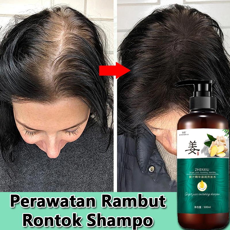 Jual Shampoo Anti Ketombe Dan Rontok Anti Rambut Rontok Anti Gatal Shampoo Rambut Rontok ...