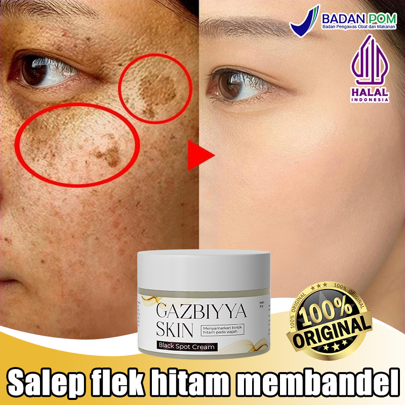 Jual Krim penghilang flek hitam cream flek hitam membandel salep flek hitam membandel 30g ...