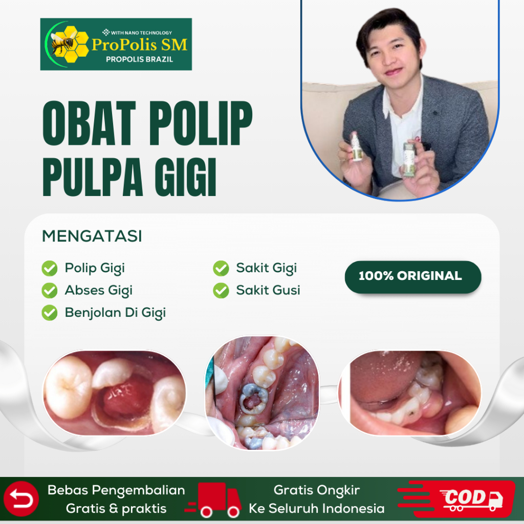 Jual Mafaza Herbs - Obat Polip Gigi, Obat Polip Pulpa, Obat Abses Gigi ...