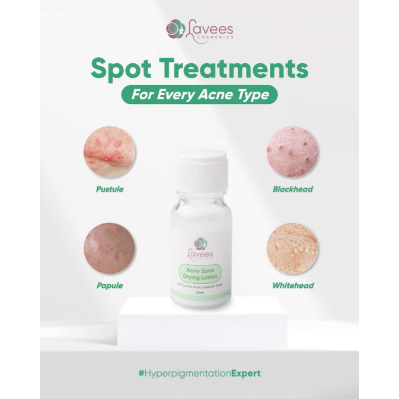 Jual Acne Spot Drying Lotion | Shopee Indonesia