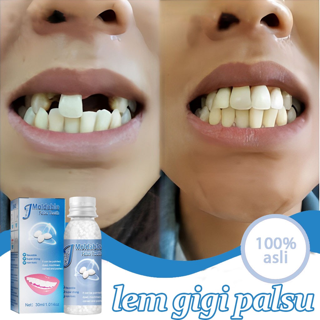Jual penambal gigi berlubang gigi palsu asli dokter permanen tambal gigi permanen 30ML lem gigi ...