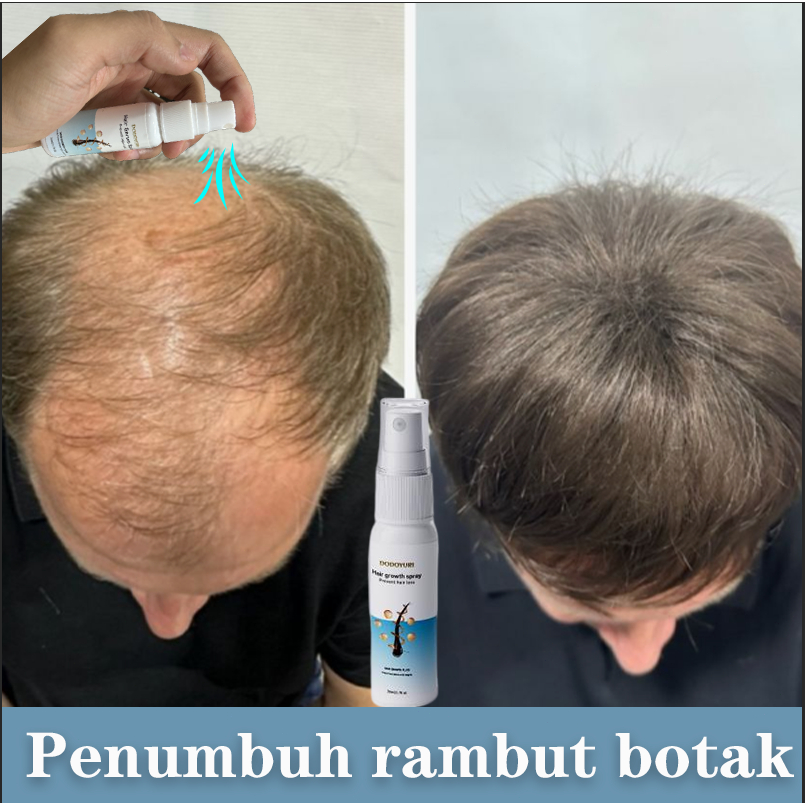 Jual (BPOM)Obat penumbuh rambut penumbuh rambut cepat serum penumbuh ...