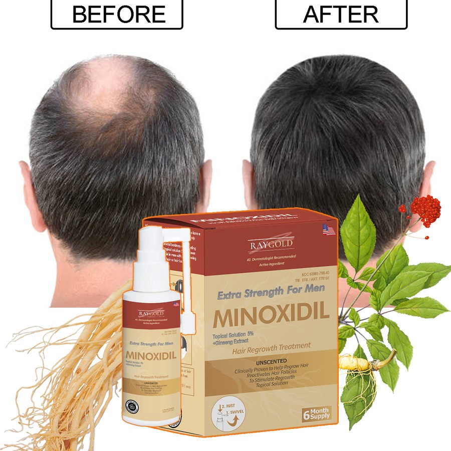 Jual MINOXIDIL5%penumbuh rambut & brewok with Ginseng extract for MEN made in USA - RAYGOLD ...