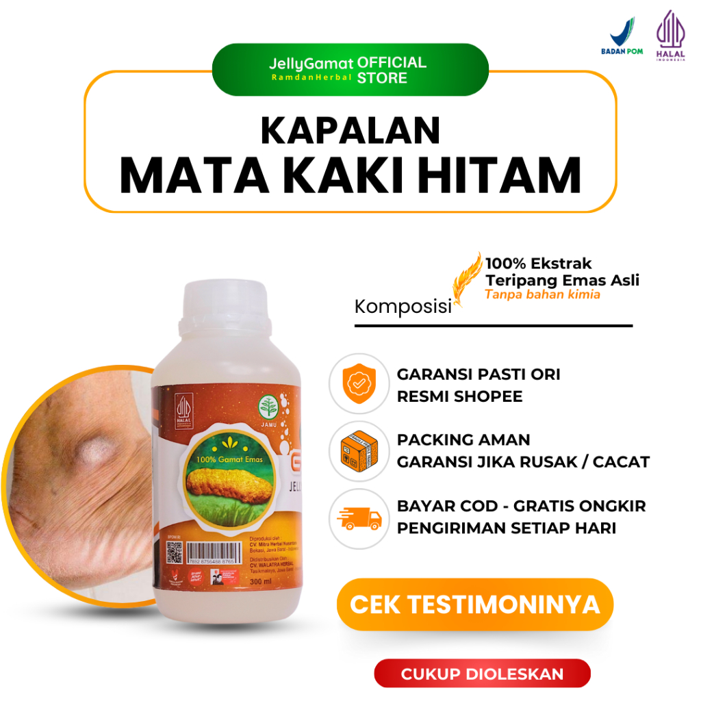 Jual Obat Kapalan Hitam Di Mata Kaki Kulit Keras Mati Kering QnC Jelly ...