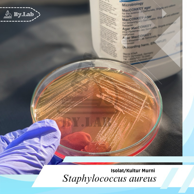 Jual Isolat/Kultur Murni Bakteri Staphylococcus aureus | Shopee Indonesia