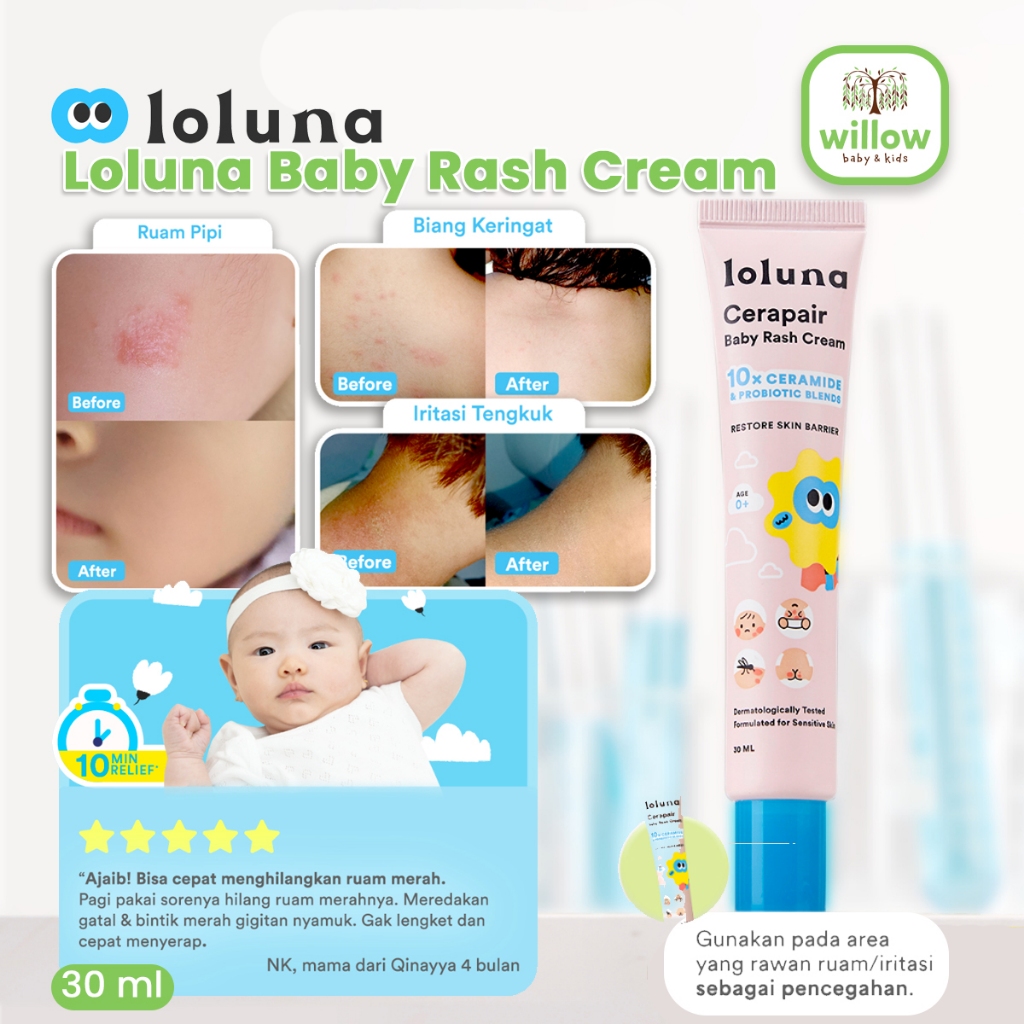 Jual Lotion Bayi - Loluna Baby Rash Cream 30Ml | Shopee Indonesia