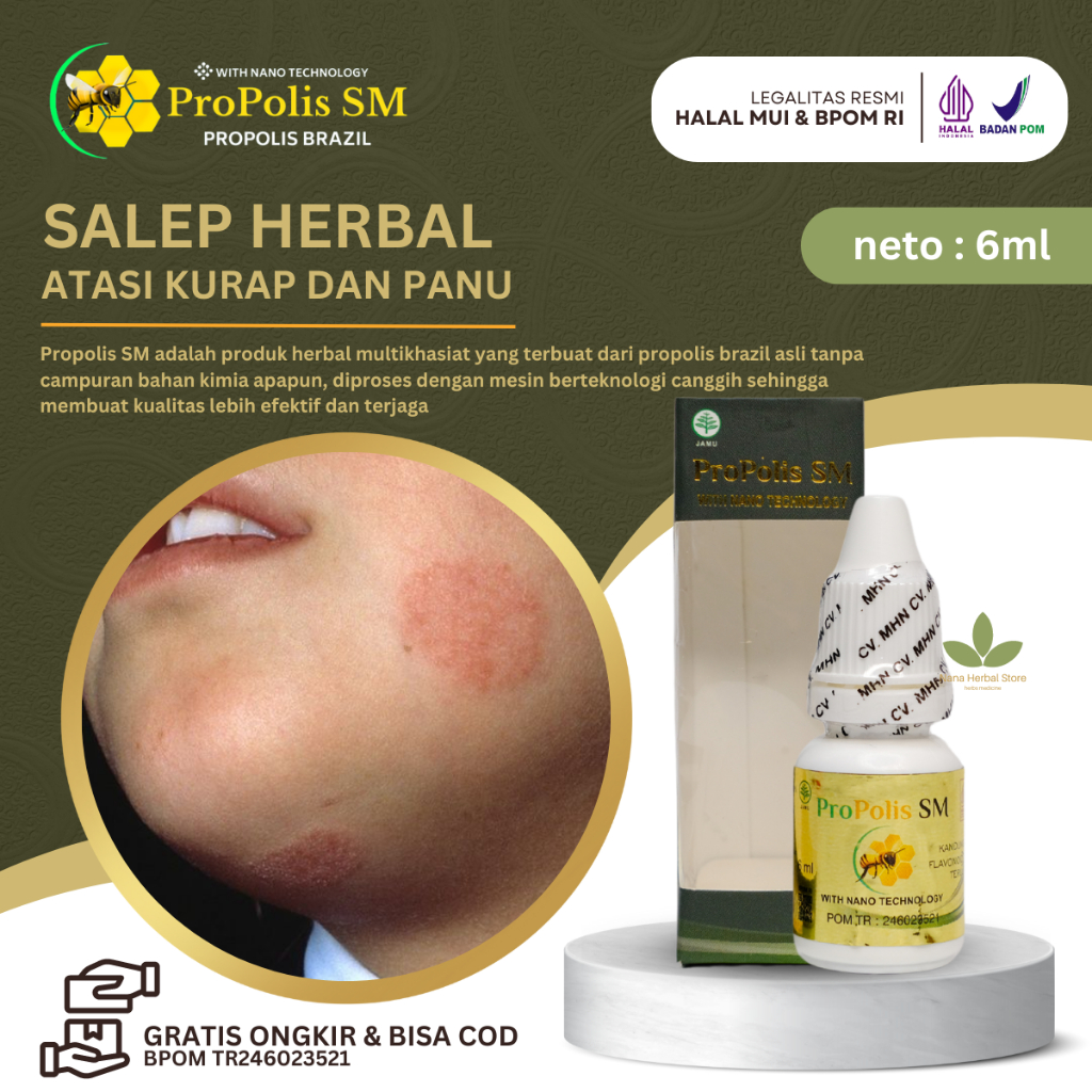 Jual Obat Kurap Kulit Gatal Panu Panuan, Obat Kadas Kudis Kutu Air ...