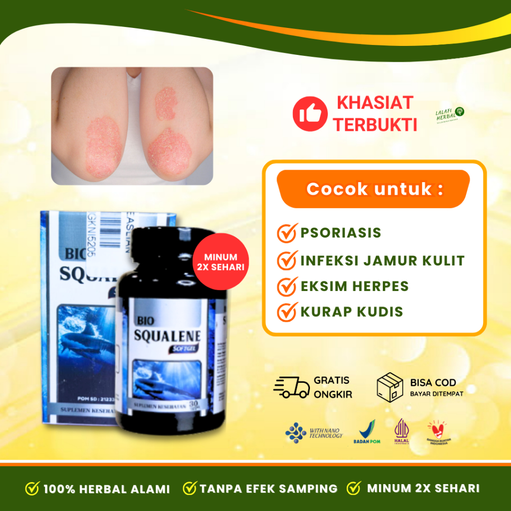 Jual Obat Minum Gatal Psoriasis Jamur Kulit Eksim Scabies Herpes Kering ...