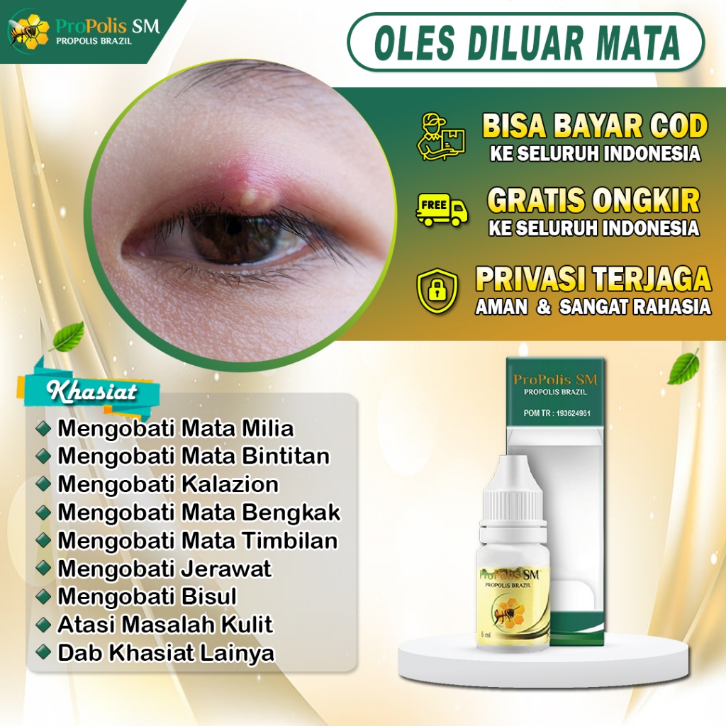 Jual Obat Mata Bintitan Bengkak Mata Kalazion Timbilan Milia Benjolan ...