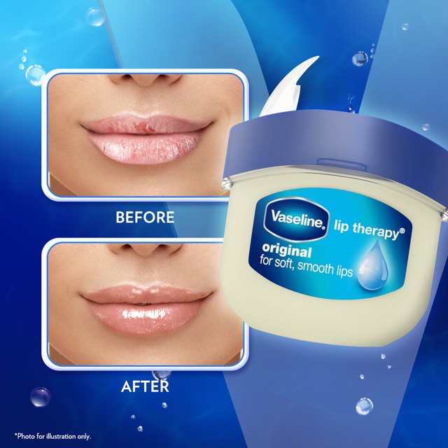 Jual Vaseline Lip Therapy Original 7gr - Pelembab Bibir - Lip Balm | Shopee Indonesia