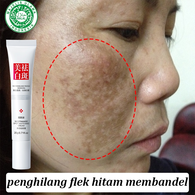 Jual cream flek hitam membandel pemutih wajah krim penghilang flek hitam 20g niacinamide Krim ...