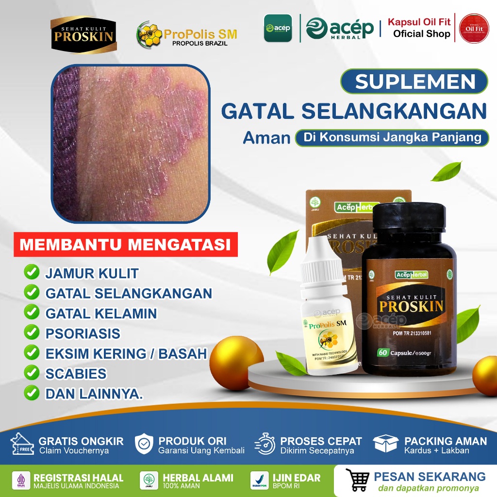 Jual Obat Gatal Selangkangan Gatal Kulit Seluruh Badan Panu Eksim ...