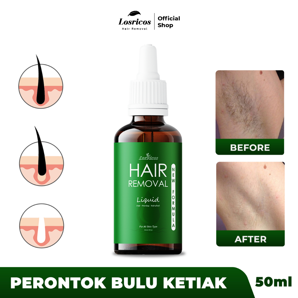Jual Perontok Bulu Ketiak Permanen BPOM - Losricos Hair Removal Liquid ...