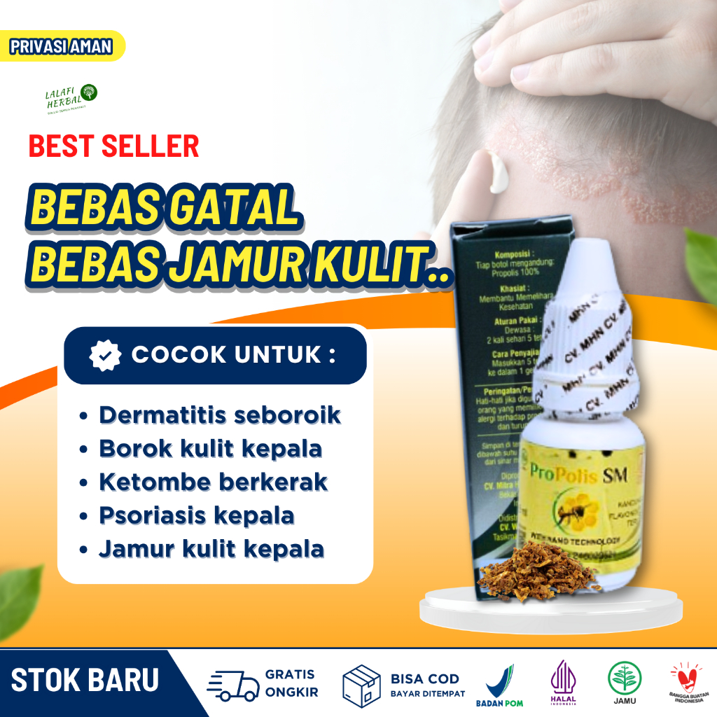 Jual Obat Dermatitis Seboroik Borok di Kepala Jamur Kulit Gatal Ketombe Kering Berkerak Propolis ...